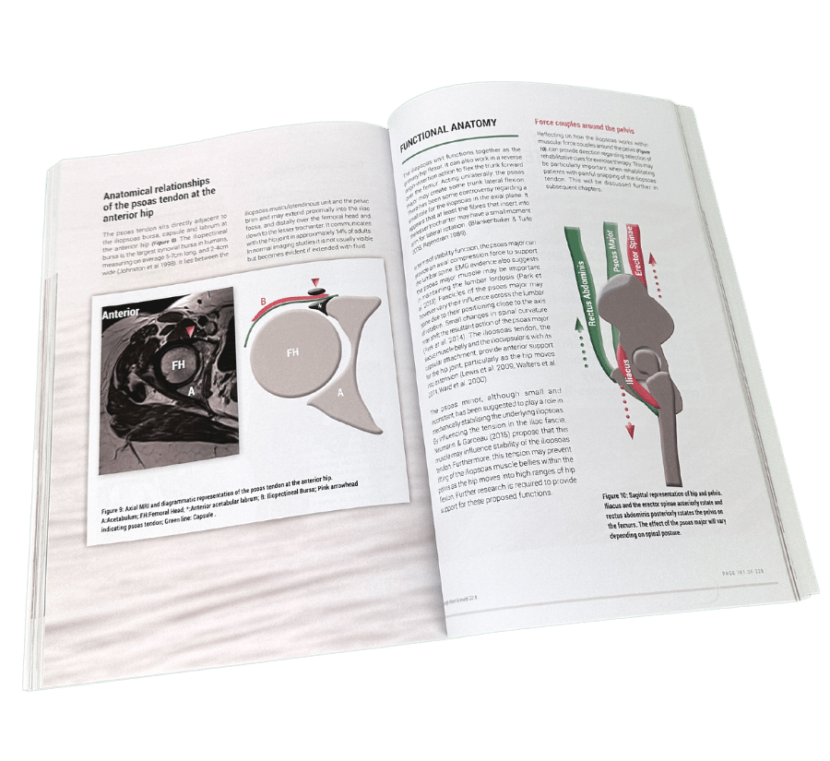 Understanding Tendinopathies of the Hip & Pelvis