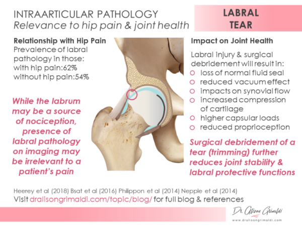 Intraarticular pathology - relevance to hip pain and joint health ...