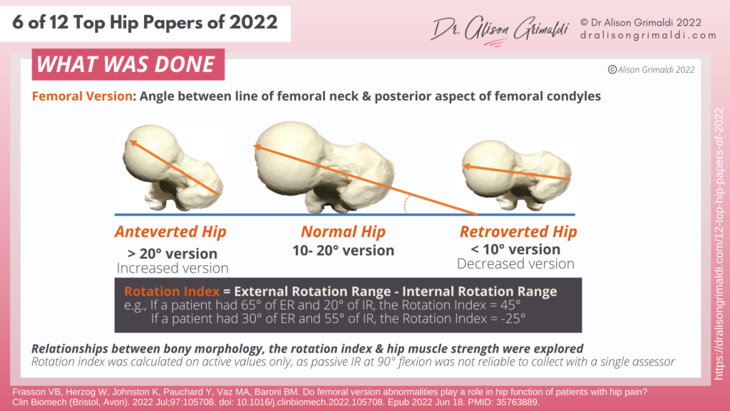Femoral version and hip function | 6 of 12 Top Hip Papers of 2022