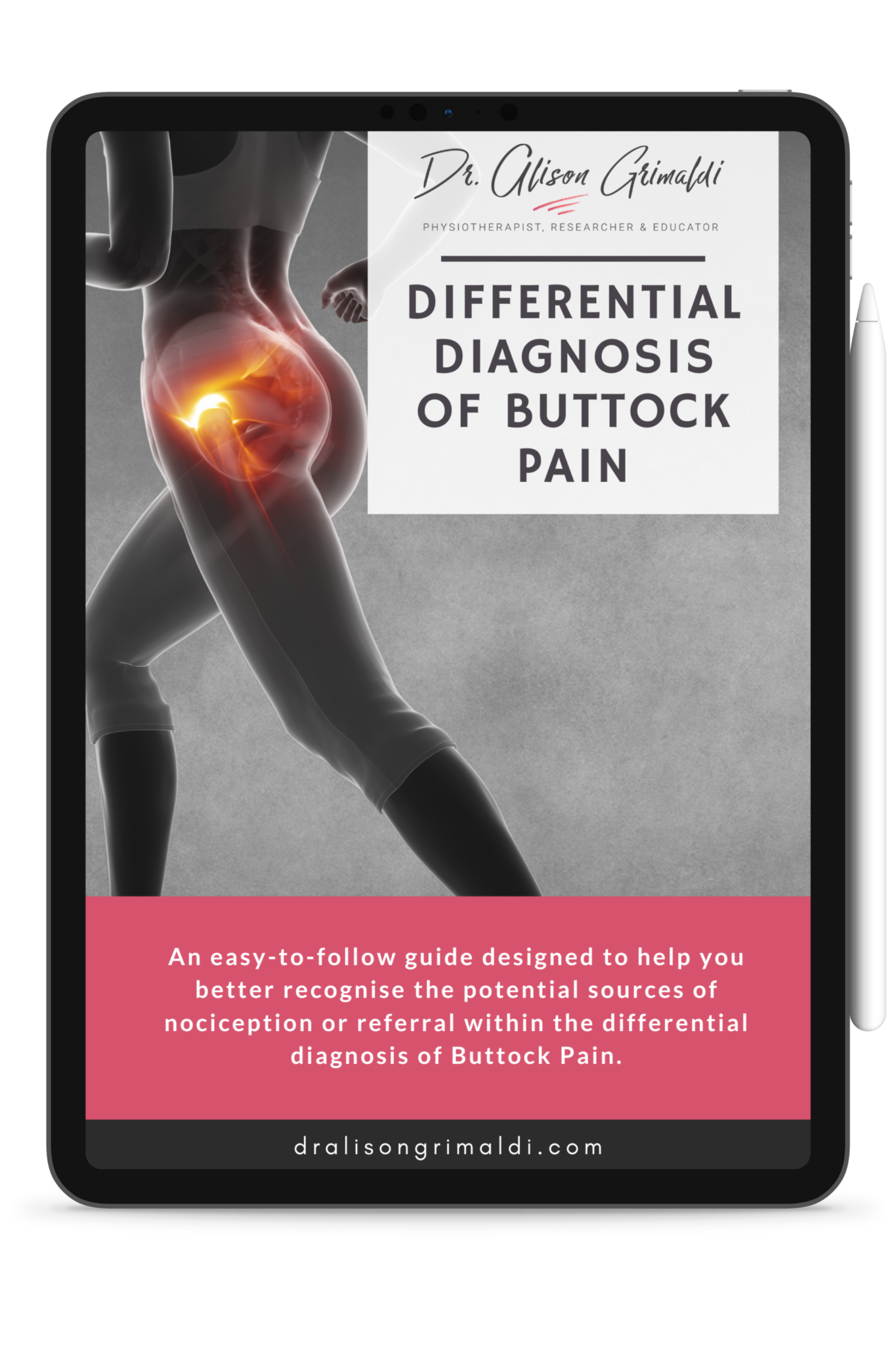 Lateral Hip and Buttock Pain Practical Workshops