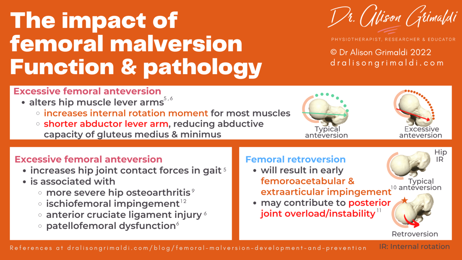 Femoral Malversion: Development and Prevention | Find out more