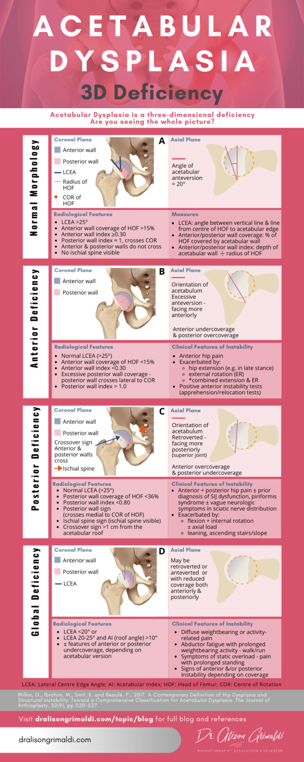 Acetabular Dysplasia - seeing the whole picture | Dr Alison Grimaldi