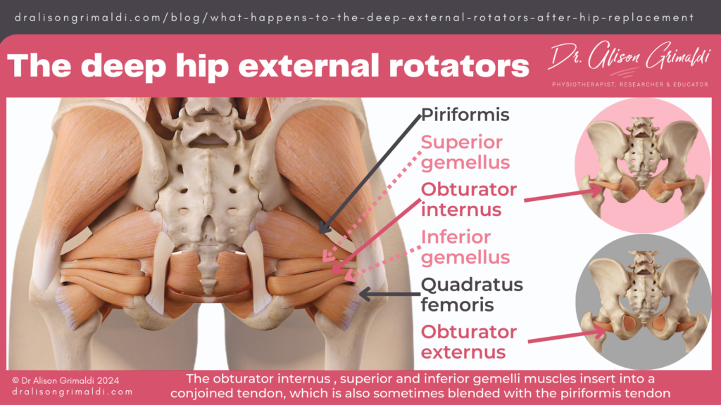 What happens to the deep external rotators after hip replacement | Find ...