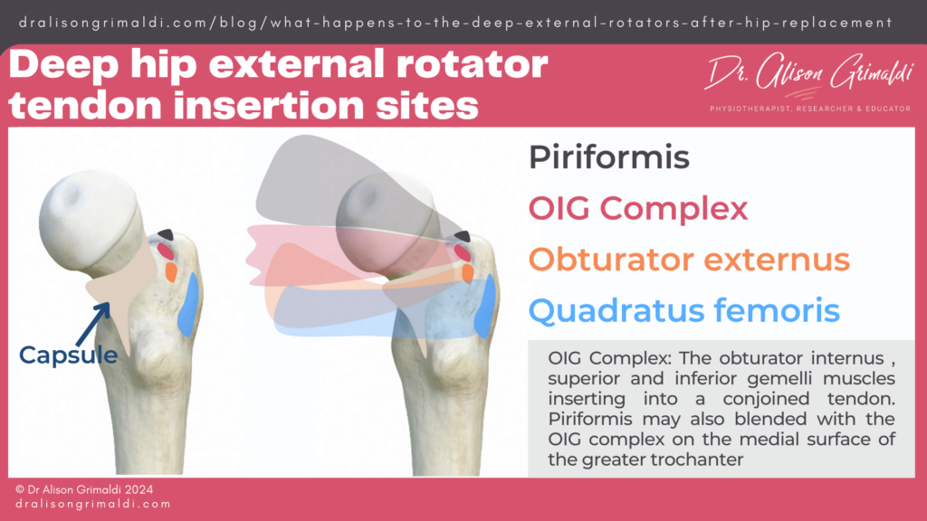 What happens to the deep external rotators after hip replacement | Find ...