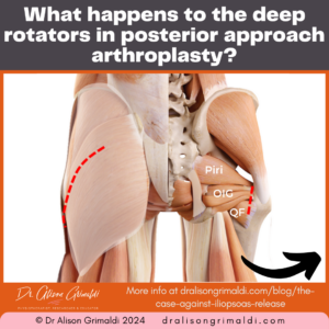 What happens to the deep external rotators after hip replacement | Find ...