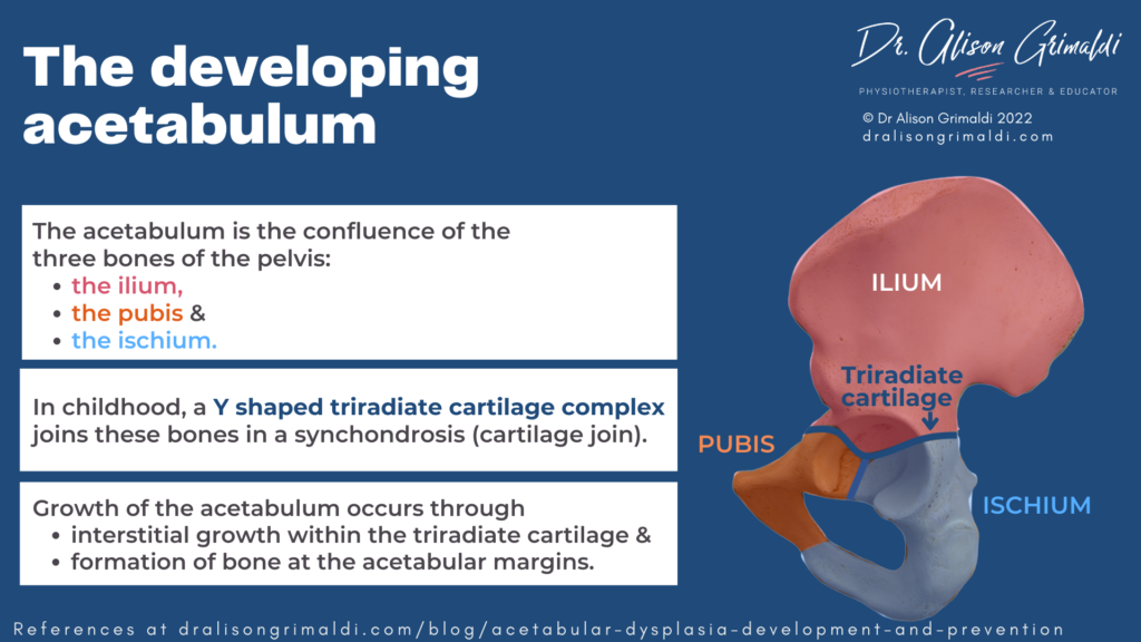 Acetabular Dysplasia: Development and Prevention | Find out more