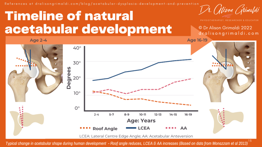 Acetabular Dysplasia: Development and Prevention | Find out more