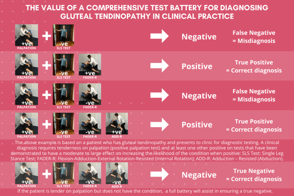 Diagnosing gluteal tendinopathy in clinical practice | Dr Alison Grimaldi