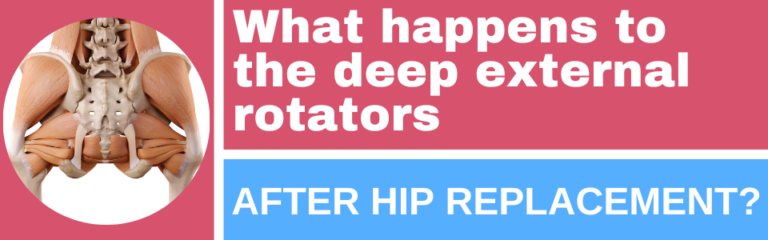 What happens to the deep external rotators after hip replacement | Find ...